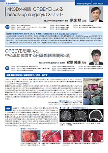 4K3D外視鏡：ORBEYEによるhead-up surgeryのメリット|動画・レポート|オリンパス医療ウェブサイト メディカルタウン